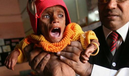 India Starving Baby - Gallery - The Sound Of Hope | indiegospel.net